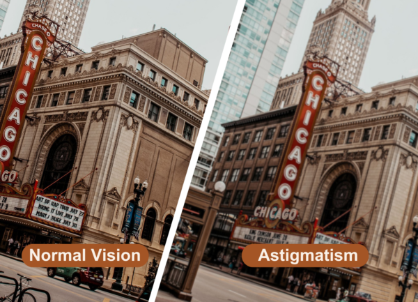 Astigmatism: Causes, Symptoms, and Treatment Option